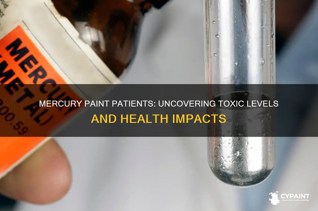 Mercury Paint Patients: Uncovering Toxic Levels And Health Impacts ...
