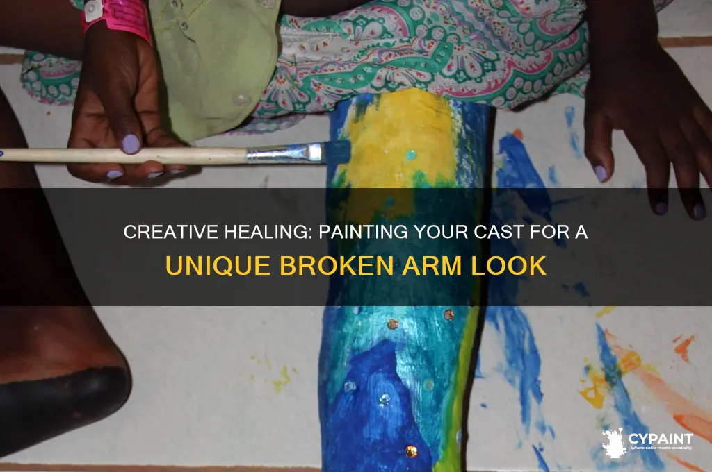 Creative Healing: Painting Your Cast For A Unique Broken Arm Look | CyPaint