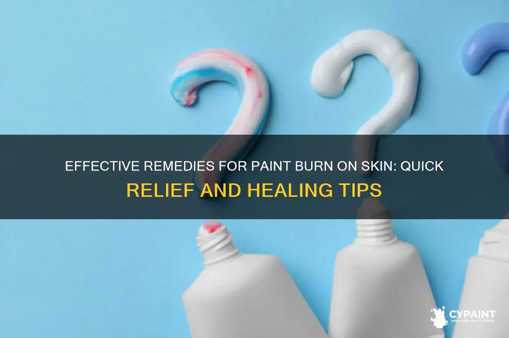 Effective Remedies For Paint Burn On Skin: Quick Relief And Healing ...